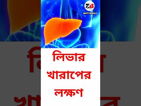 লিভার খারাপের লক্ষণ #shortsvideo #shorts #liverdisease