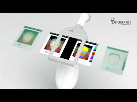 Rayplicker, the Tooth Shade Analyzer