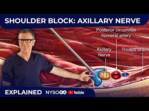 Shoulder Block: Axillary Nerve