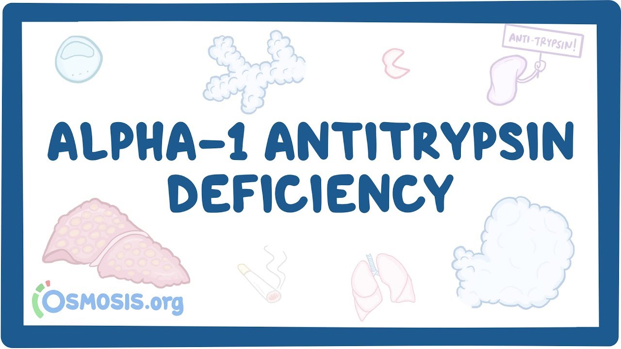 Alpha-1 Antitrypsin Deficiency - causes, symptoms, diagnosis, treatment, pathology