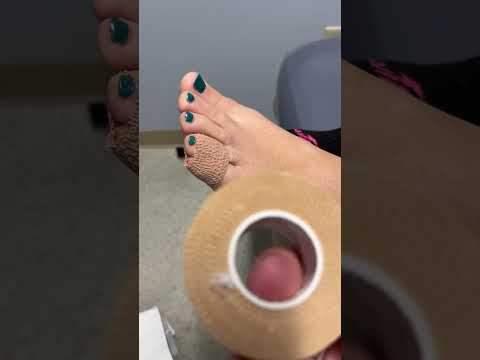 Is tape or Coban better for a toe fracture?