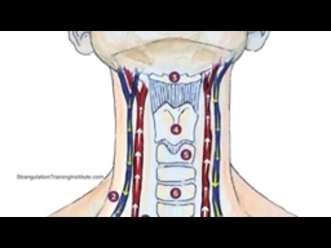 Strangulation - A Predictor of Future Violence