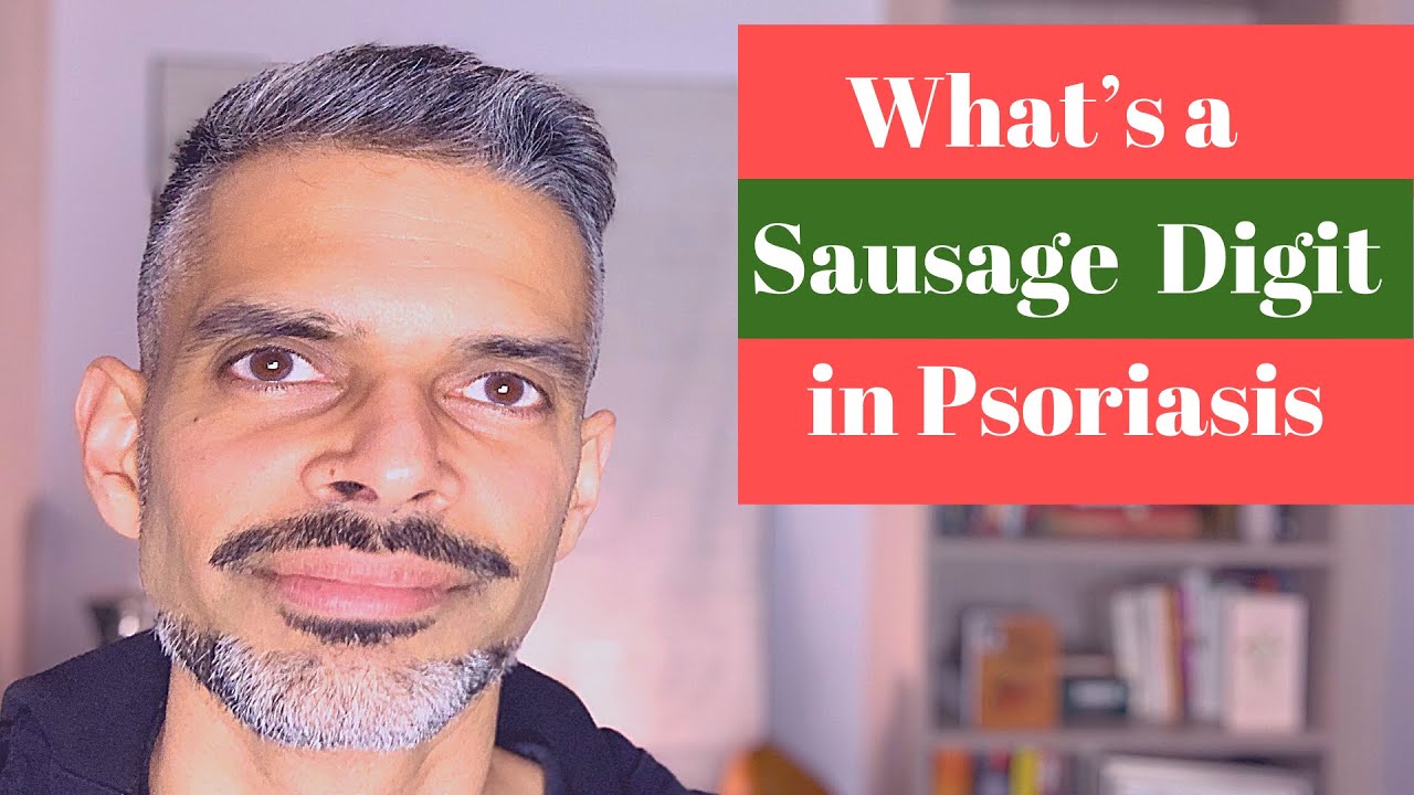 Sausage Digit in Psoriasis - Chicago Arthritis and Regenerative Medicine
