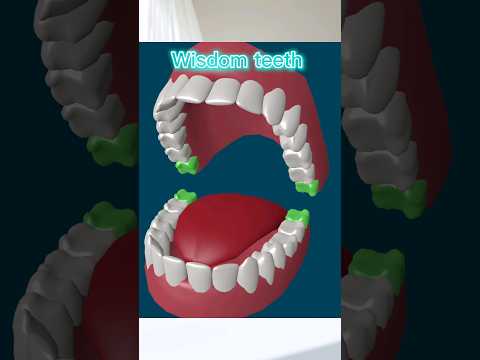 WISDOM TEETH - MEDICAL DEFINITION | Medical Consecutive Interpreting