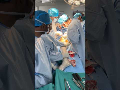 How surgeons control bleeding during surgery? - Answer in comments