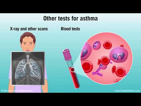 Diagnosing Asthma: Mild, Moderate, and Severe