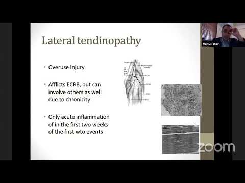 Lateral elbow Pain
