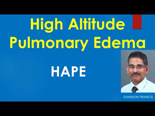 What is high altitude pulmonary edema? Morgan Chesky's health scare ...