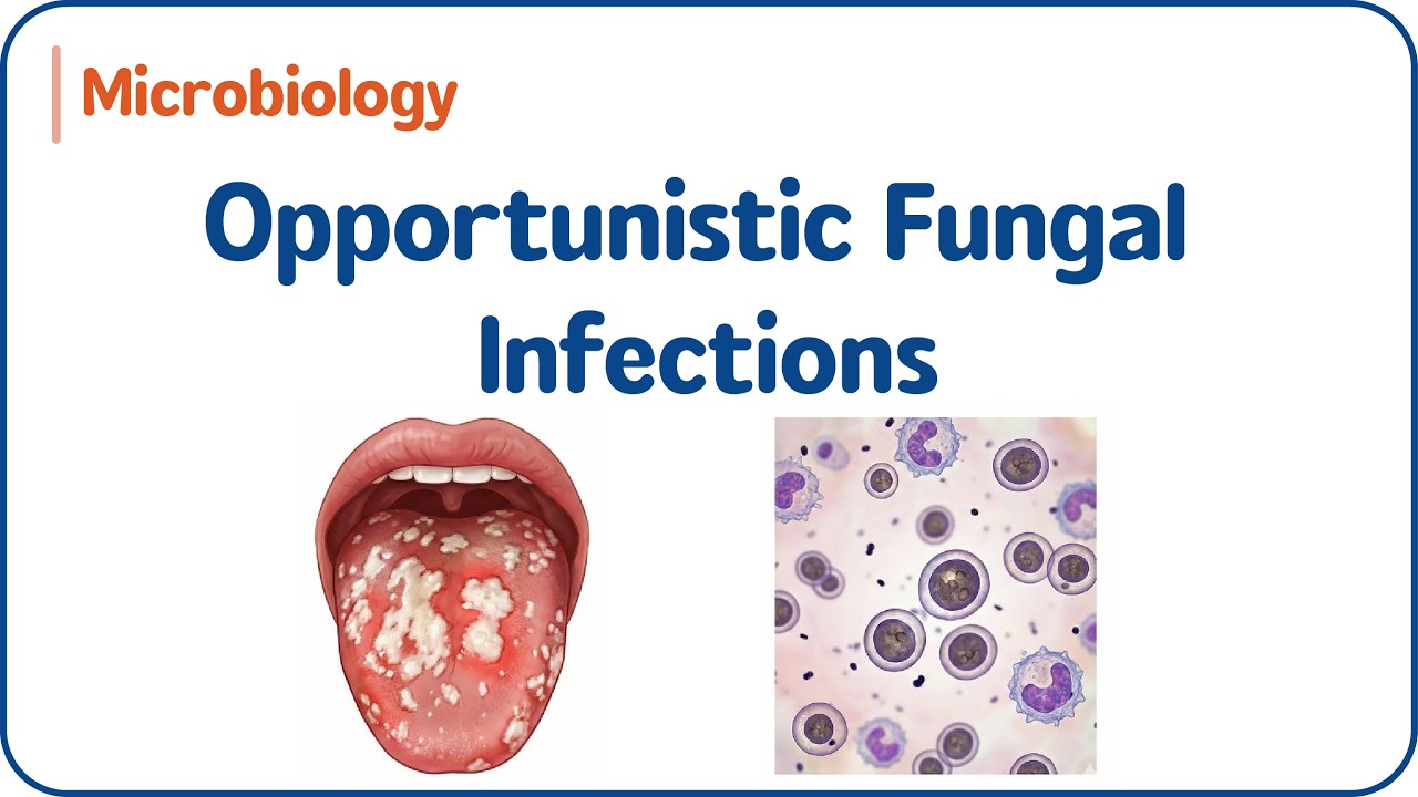 8. Opportunistic Fungal Infections Explained | Immunocompromised Hosts | USMLE Step 1 🧬⚡