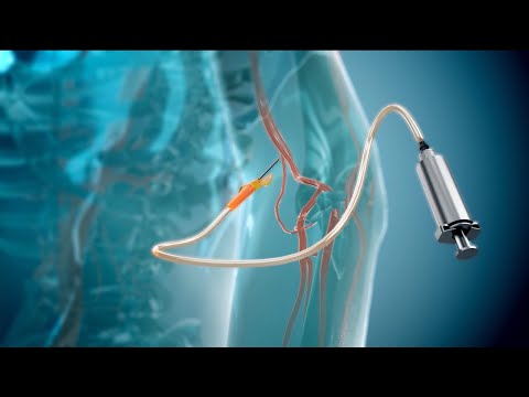 FDA approves new diagnostic that can help beat Prostate Cancer