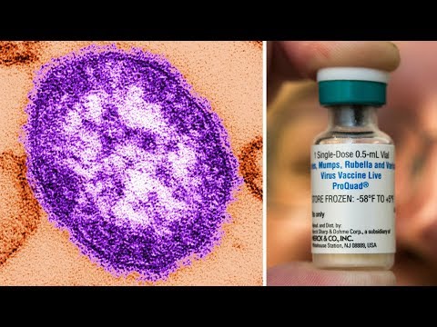What is measles? What to know about symptoms, vaccine & treatment