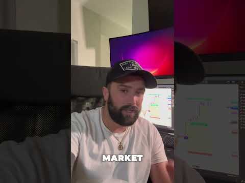 Best Broker for Forex Trading : Why StoicFX Is a Game Changer!