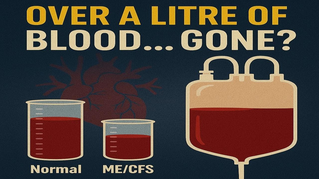 Blood Volume Loss in ME/CFS: What the Research Reveals