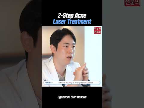 2-Step Laser Treatment for Acne