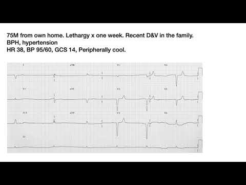 Prehospital Bradycardia Cases