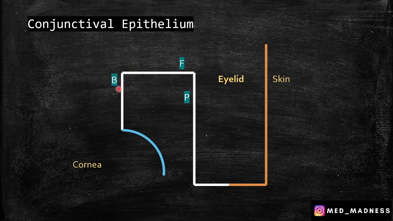 Conjunctiva Histology | Parts of Conjunctiva | Eyelid | Med Madness