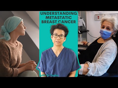 What Is Metastatic Breast Cancer And Will I Get It? With Dr Tasha