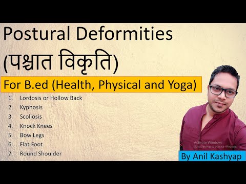Postural Deformities |For B.ed (Health, Physical and Yoga)| By Anil Kashyap