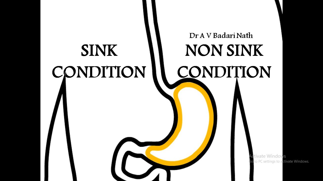Sink Condition & Non sink Condition