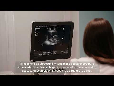 what is meant by echogenicity in ultrasound.hypoechoic and Hyper echoic terms on ultrasound