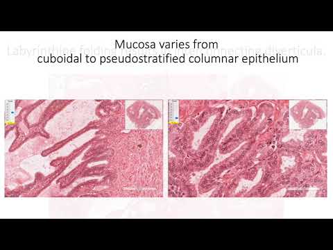 Histology with Chimmalgi: Seminal vesicles