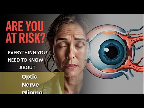 Optic Nerve Glioma Explained Causes, Symptoms and Treatment, All Insights