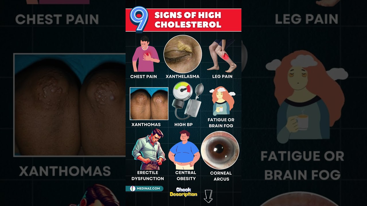 High Cholesterol Symptoms: What Your Body Is Trying to Tell You