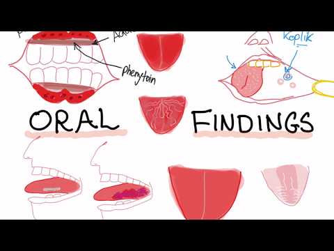 Oral lesions and diseases associated with them