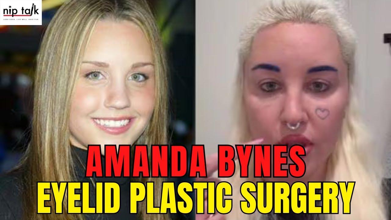 Amanda Bynes Eyelid Plastic Surgery
