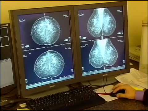 News12 coverage of Women's HealthCare Imaging.mov