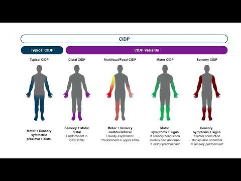 Optimizing Outcomes in CIDP: Honing Diagnostic Accuracy, Personalizing Treatment Plans