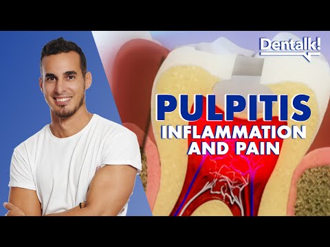 TOOTHACHE? It could be PULPITIS - Tooth pain RELIEF and CAUSES of inflamed pulp | Dentalk! ©