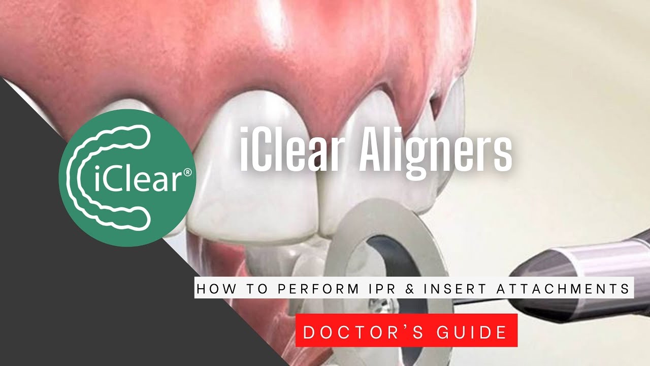 How to perform IPR and insert attachments with clear aligners-FULL TUTORIAL