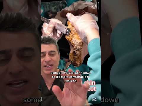 Doctor Reacts To Foot With Excess Skin!