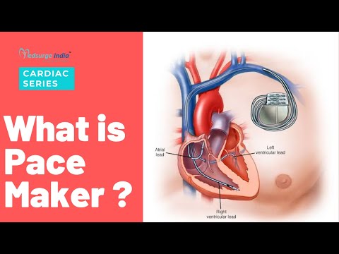 What is Pacemaker | Pacemaker in Heart