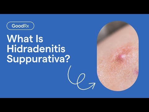 Hidradenitis Suppurativa, Explained: Symptoms, Causes, and Complications | GoodRx