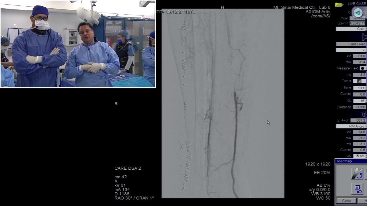 Peripheral Interventions Webcast January 25, 2017