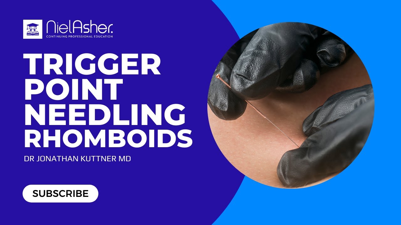 Dry Needling Medical Acupuncture Trigger Point Release - Rhomboid Muscles