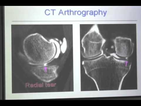 MRI of the Knee for the Practicing Orthopaedic Surgeon by Steven Meyers, MD
