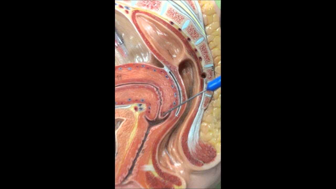 Large Female Reproductive model