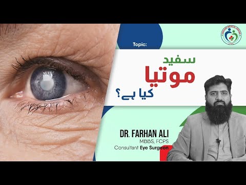 What is white Cataract in Urdu | Understanding White Cataract Surgery in Urdu