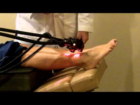 Cold Laser Therapy Treatment for Neuropathy caused by Diabetes
