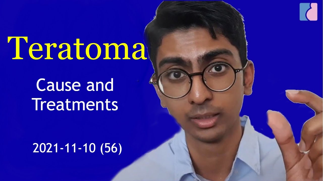 Teratoma: Cause and Treatment