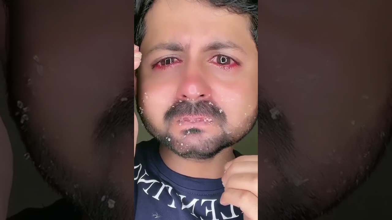 can I smile 🥺 #foryou #memes #funny #cringe