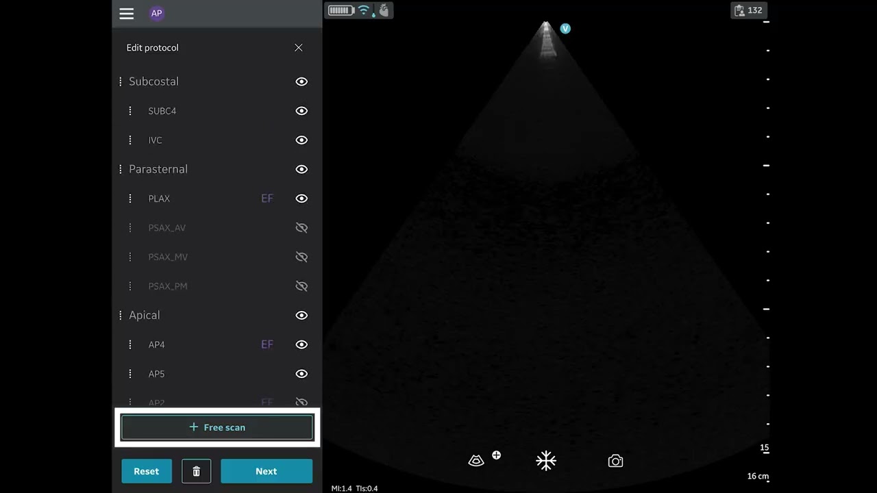 Vscan Air™ SL with Caption AI™ Tutorial | Scanning protocol