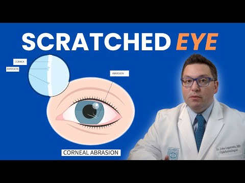 Why Does My Eye Hurt? Corneal Abrasions (scratched eye)