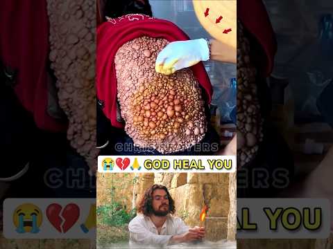 Prayer for Healing & Recovery ???????????? • #0206
