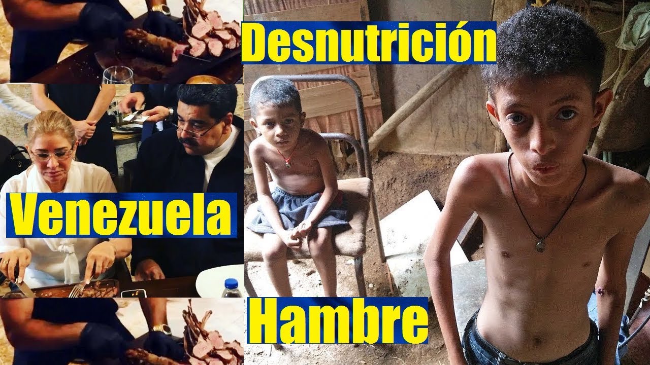 Venezuela: Hambre y desnutrición infantil
