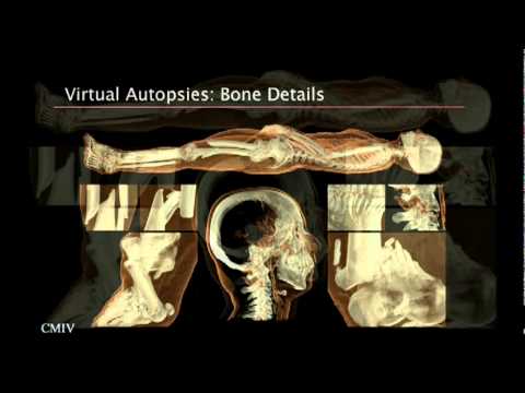 Anders Ynnerman: Visualizing the medical data explosion