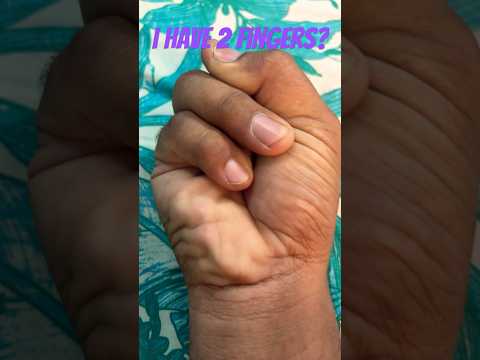 my others 3 fingers were? looking amazing today game#fingers#games#bwp studio#shorts#